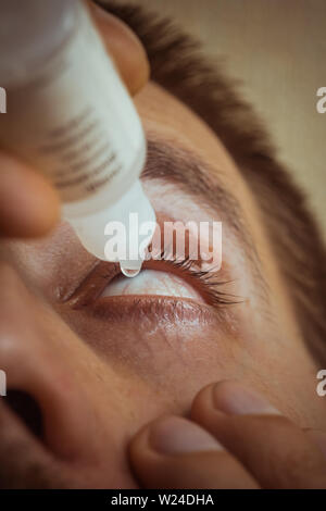 a man drips open human eye with bright red arteries drops to improve ...