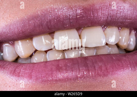 Woman smile with great natural teeth Stock Photo - Alamy