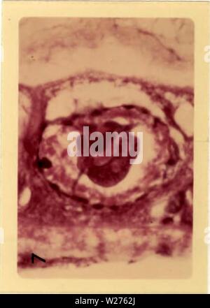 Nuclear Polyhedrosis Virus Stock Photo - Alamy