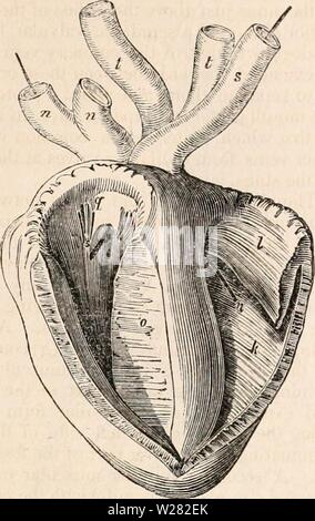 Vintage illustration of anatomy of the right ventricle of a heavily ...