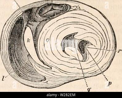 Vintage illustration of anatomy of the right ventricle of a heavily ...