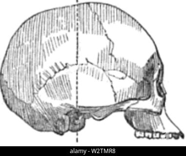 Eskimo skull Mongoloid 2 Stock Photo - Alamy