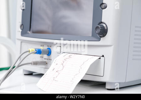Close-up shot of Cardiotocograph machine or Electronic Fetal Monitor ...