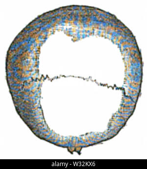 Tartary Mongoloid skull Stock Photo - Alamy