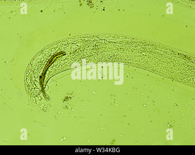the tail of Aelurostrongylus abstrusus, cat lungworm under the ...