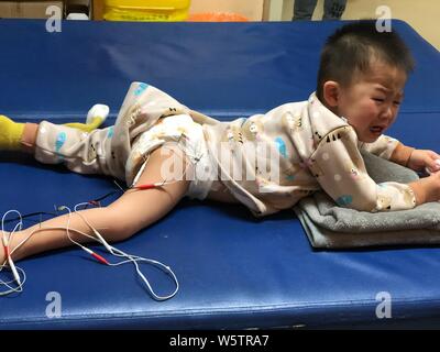 2-year-old physically handicapped baby Wenbo from southern China's ...