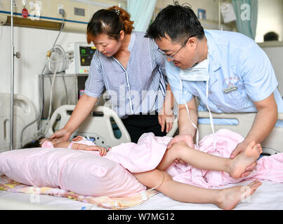 The five-year-old girl Lele is undergoing therapy after doing a simple ...