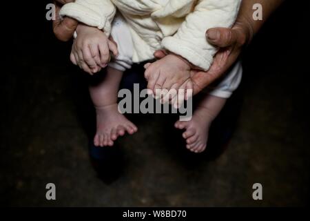 The feet of the three-month-old baby boy Hong Hong who has 15 fingers ...