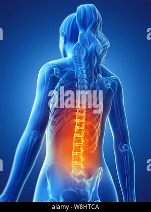 Back pain, conceptual computer artwork Stock Photo - Alamy