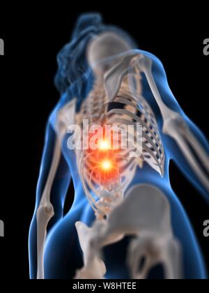 Back pain, conceptual computer illustration Stock Photo - Alamy