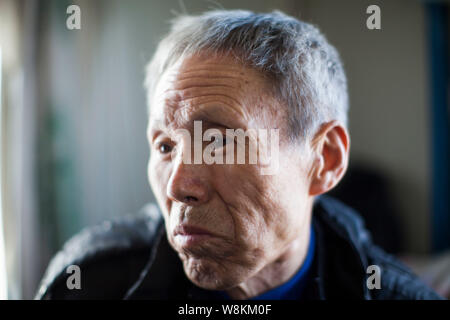 63-year-old armless farmer Sun Jifa, right, who is equipped with his ...