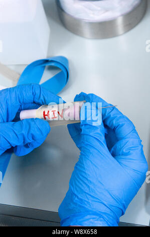 scientist prepare blood sample for research on microscope. Placing ...