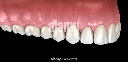 Maxillary human gum and teeth. Medically accurate tooth 3D illustration ...
