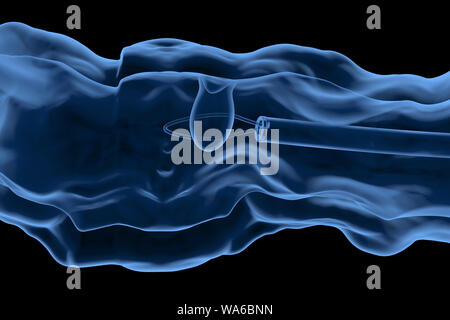 3d rendering x-ray endoscope remove colonic polyp with wire loop Stock Photo - Alamy