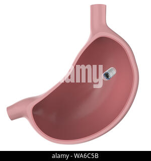 STOMACH, ENDOSCOPY EXAMINATION Stock Photo - Alamy