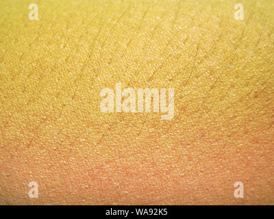 Detailed texture of female skin. Close up shot of young african ...