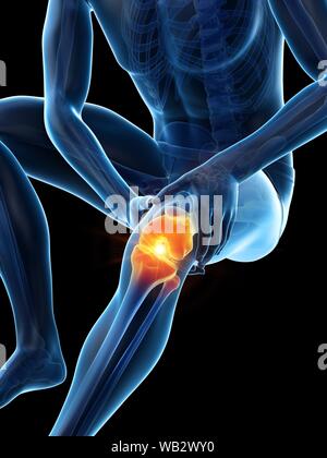 Knee pain, conceptual illustration Stock Photo - Alamy