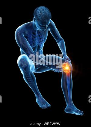 Knee pain, conceptual illustration Stock Photo - Alamy
