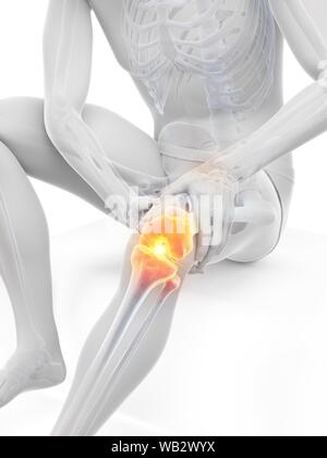 Knee pain, conceptual illustration Stock Photo - Alamy