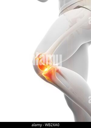 Knee pain, conceptual illustration Stock Photo - Alamy