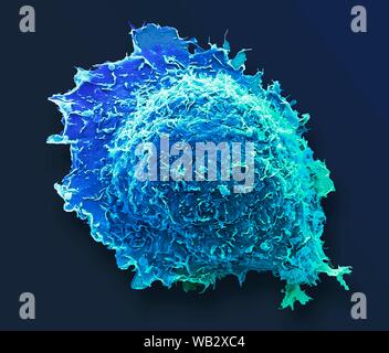 Osteoblast bone cell. Coloured scanning electron micrograph (SEM) of an ...