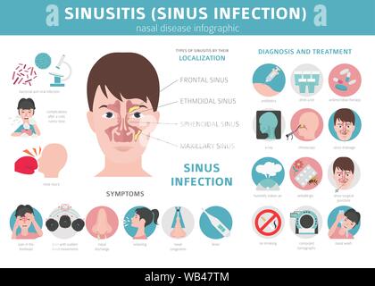 Nasal diseases. Sinusitis, sinus infection diagnosis and treatment ...