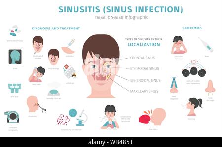 Nasal diseases. Sinusitis, sinus infection diagnosis and treatment ...