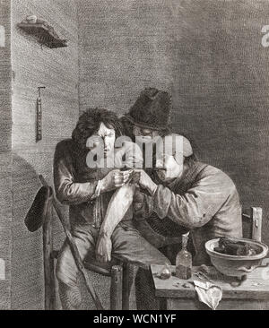 Medical Operation in the 17th century. From Ambroise Paré 's Stock ...