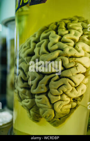 Real human brain in a glass jar Stock Photo - Alamy