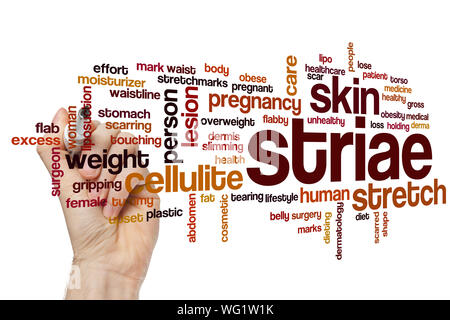 Striae word cloud concept Stock Photo - Alamy