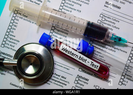 Concept of Western Blot - Test with blood sample. Healthcare or medical ...