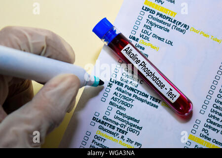 Liver Enzyme - Test with blood sample. Top view isolated on office desk ...