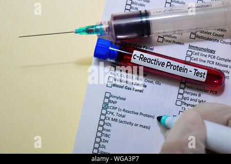 Protein S - Test with blood sample. Top view isolated on office desk ...