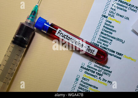 Fructosamine - Test with blood sample. Top view isolated on office desk ...