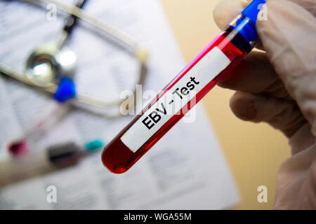 EBV - Test with blood sample. Top view isolated on office desk ...
