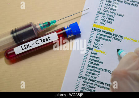 Triglyceride - Test with blood sample. Top view isolated on office desk ...
