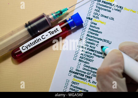Concept of Cystatin C - Test with blood sample. Healthcare or medical ...