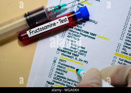 Fructosamine - Test with blood sample. Top view isolated on office desk ...