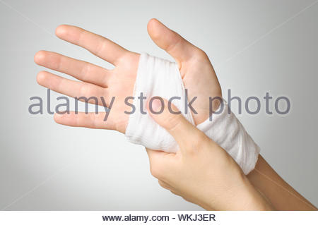 Injured palm hand close up with blister Stock Photo: 218798718 - Alamy