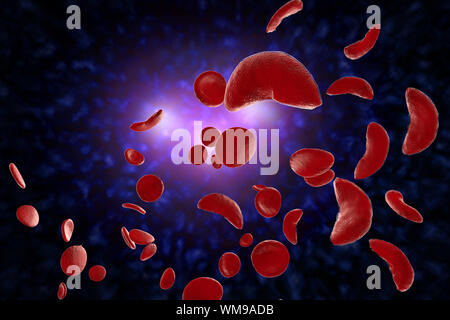 Sickle cell anemia disease (SCD) blood cells 3D illustration Stock ...