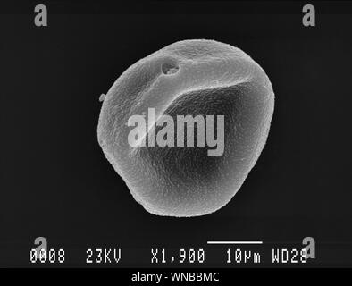 Scanning electron micrograph (SEM) of Dust mite egg. (Dermatophagoides ...