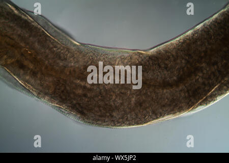 Echinococcus parasites in infected liver Stock Photo - Alamy