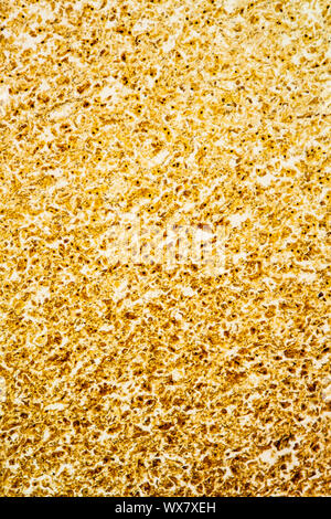 Syphilis Lues, tissue 200x Stock Photo - Alamy