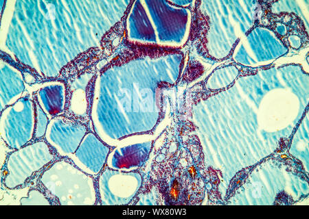 Struma colloides goiter tissue 100x Stock Photo - Alamy