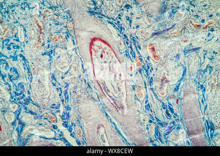 Hair follicle mite skin tissue under the microscope 100x Stock Photo ...