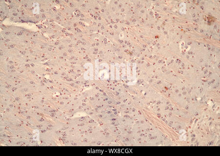 Mouse brain tissue under the microscope 100x Stock Photo - Alamy