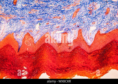 Scar skin tissue under the microscope 100x Stock Photo - Alamy