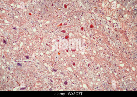 Nerve tissue under the microscope 100x Stock Photo - Alamy