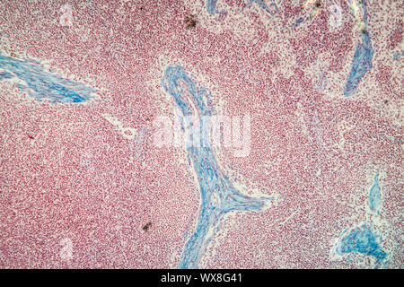 Lymph node tissue under the microscope 100x Stock Photo - Alamy