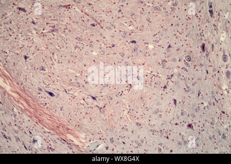 Nerve cells under the microscope 100x Stock Photo - Alamy